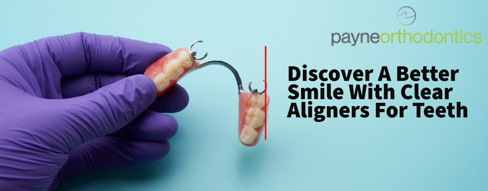 #1 Bets Clear Aligners for Teeth – Discover a Better Smile